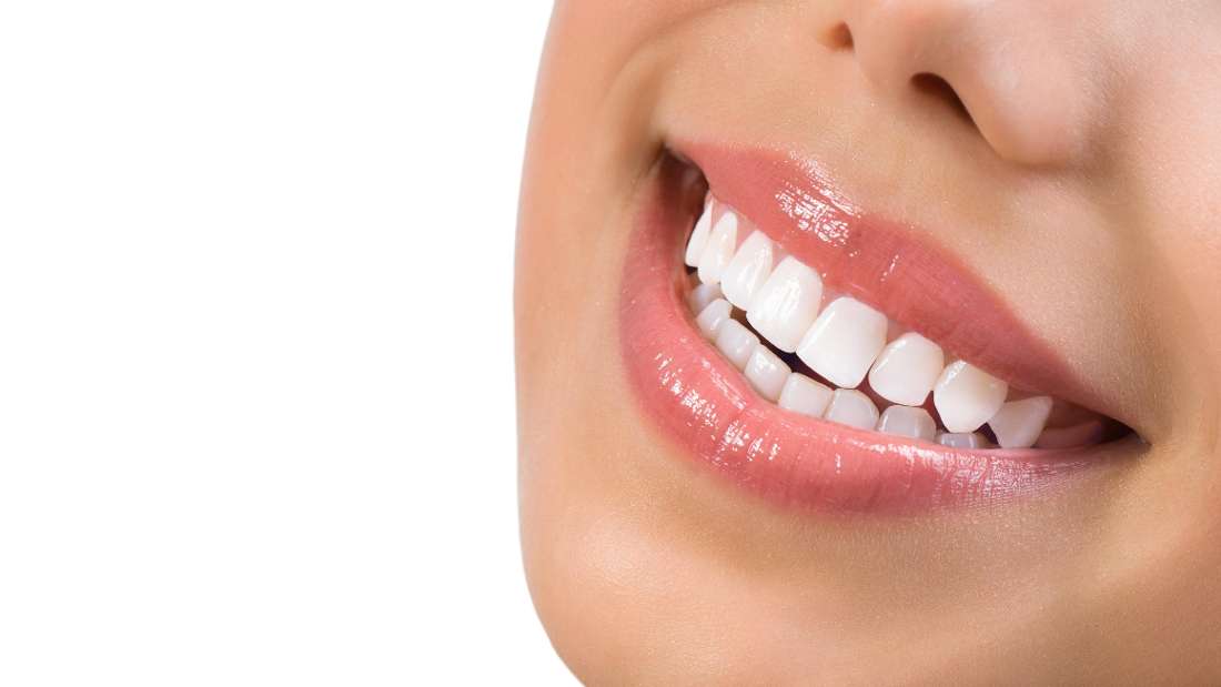 How to Keep Your Veneers Looking Great | Porcelain Veneers Aurora Colorado